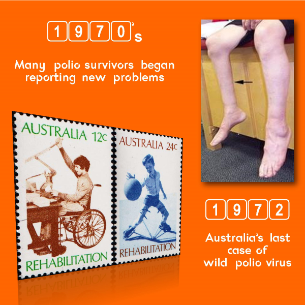 14 Timeline 600x600 Polio Australia